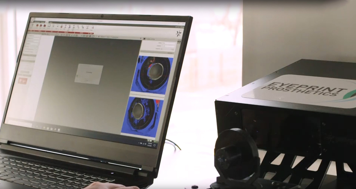EyePrint Prosthetics - Dr. Sam Dhaliwal & Associates
